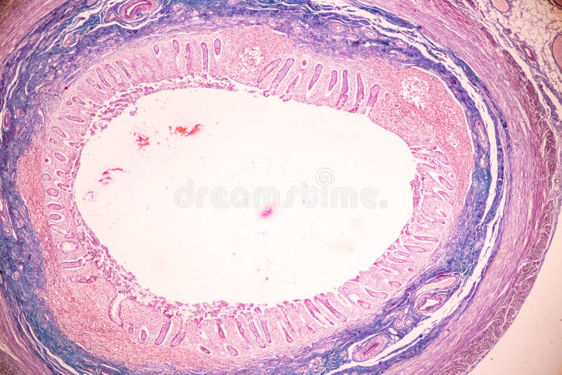Small Intestine Cross Section Stock Photos - Free & Royalty-Free Stock ...