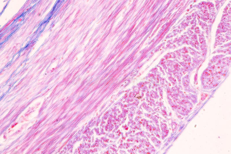 Small Intestine Duodenum and Vermiform Appendix Human Under the ...