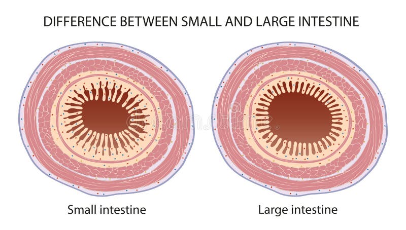 Difference between Small and Large Intestine Stock Illustration ...