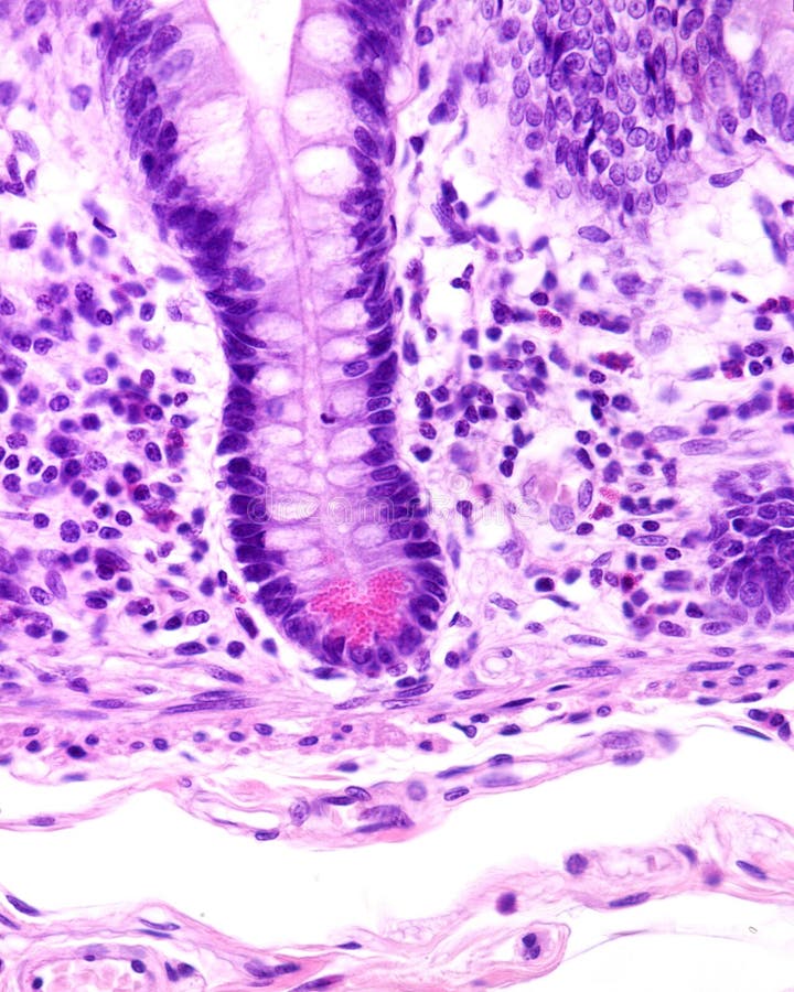 Small Intestine. Paneth Cells Stock Photo - Image of microscopy, crypts ...