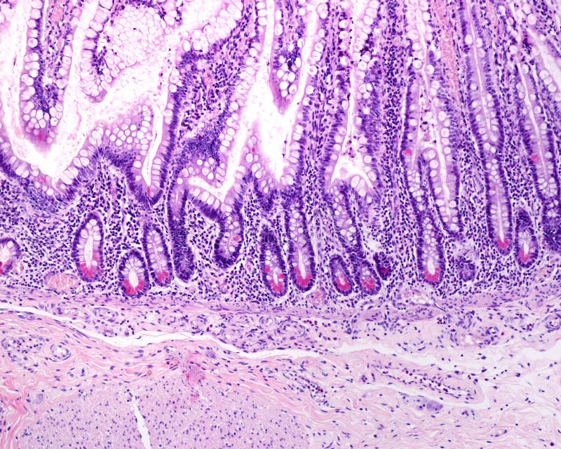 Small Intestine. Paneth Cells Stock Image - Image of cell, lieberkuhn ...