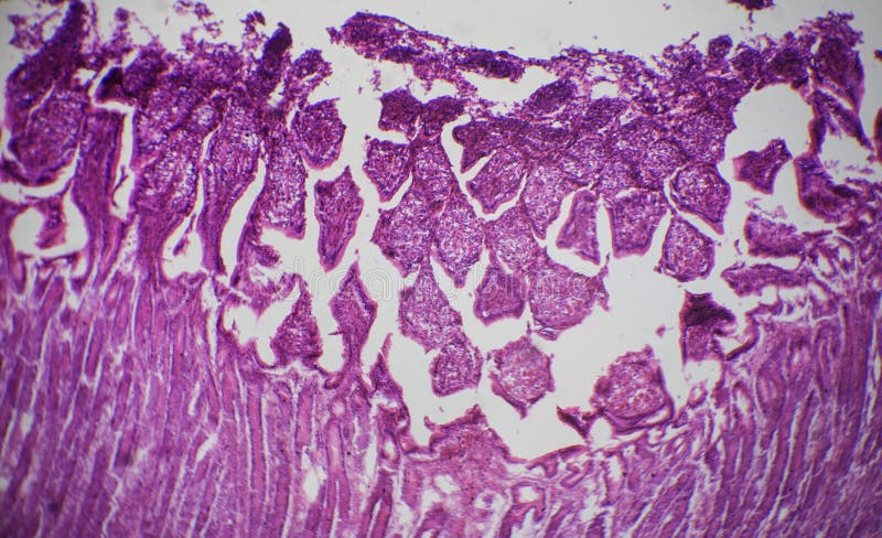 Small Intestine Section Under the Microscope Stock Image - Image of ...