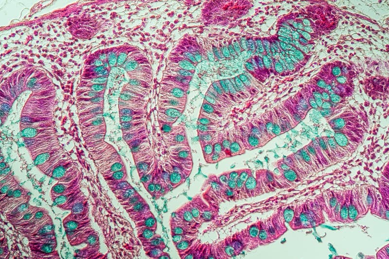 Small Intestine with Villi Under the Microscope Stock Image - Image of ...