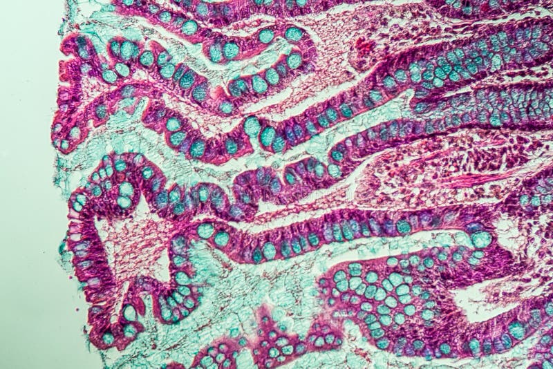 Small Intestine with Villi Under the Microscope Stock Photo - Image of ...