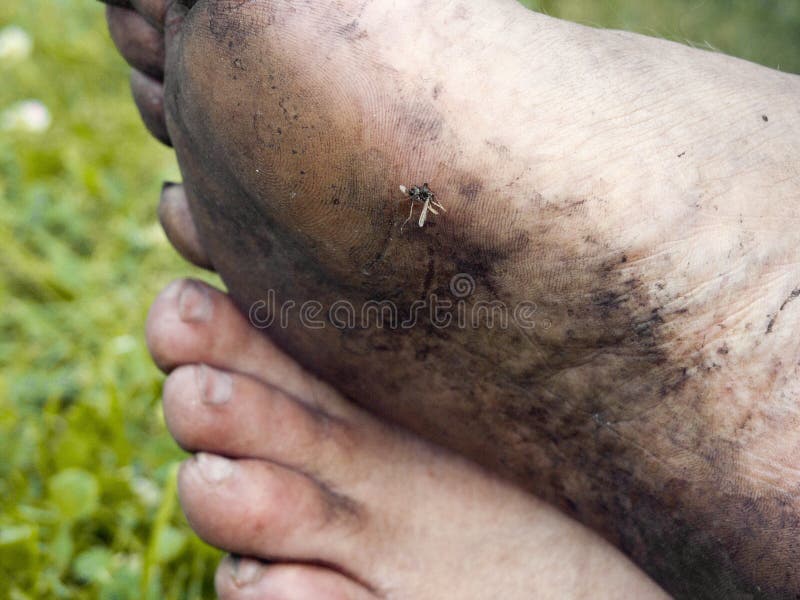Smashed Mosquito on the Bare Feet Stock Photo - Image of diseases ...