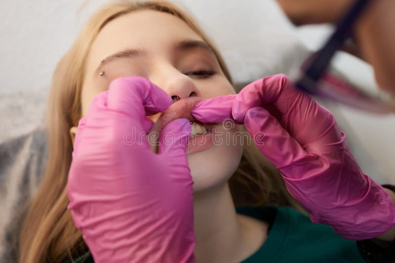 Smile or Frenulum Piercing Under the Upper Lip. Stock Image - Image of ...