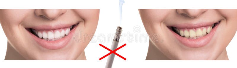 Smile before and after Smoking. Stock Image - Image of danger, health ...