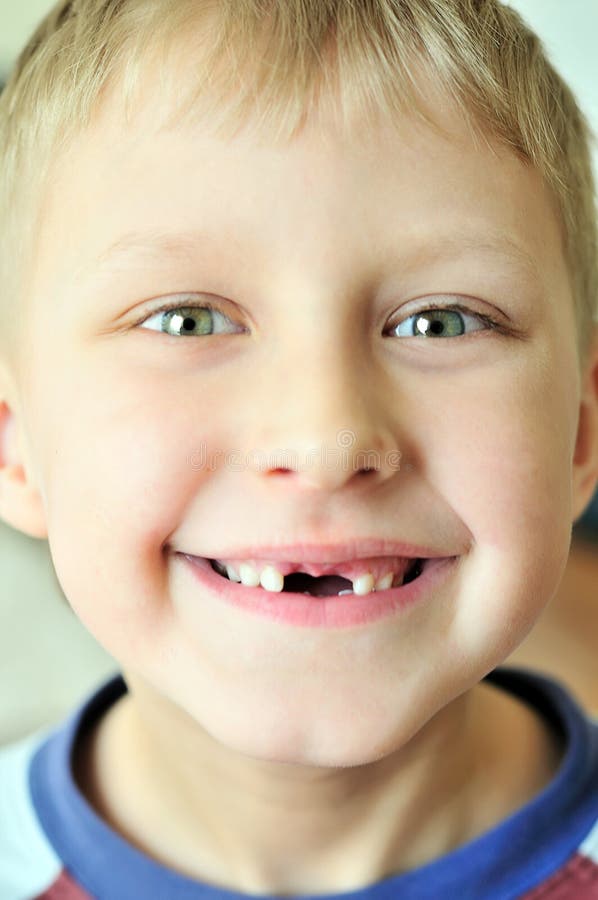 1,005 Toothless Child Closeup Smile Stock Photos - Free & Royalty-Free ...