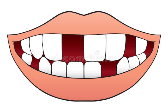 Mouth with Missing Teeth stock vector. Illustration of gone - 106469689