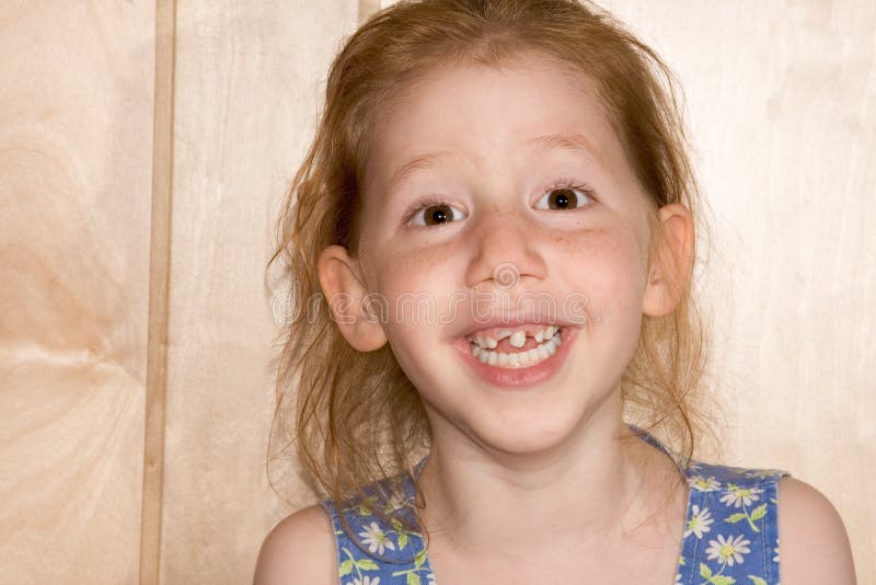 Smiling Girl Showing Her Fallen Off Snaggle Teeth Stock Photos - Free ...