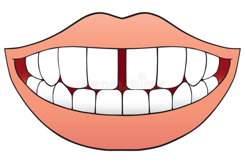 Teeth Gap Cartoon Stock Illustrations – 125 Teeth Gap Cartoon Stock Illustrations, Vectors ...