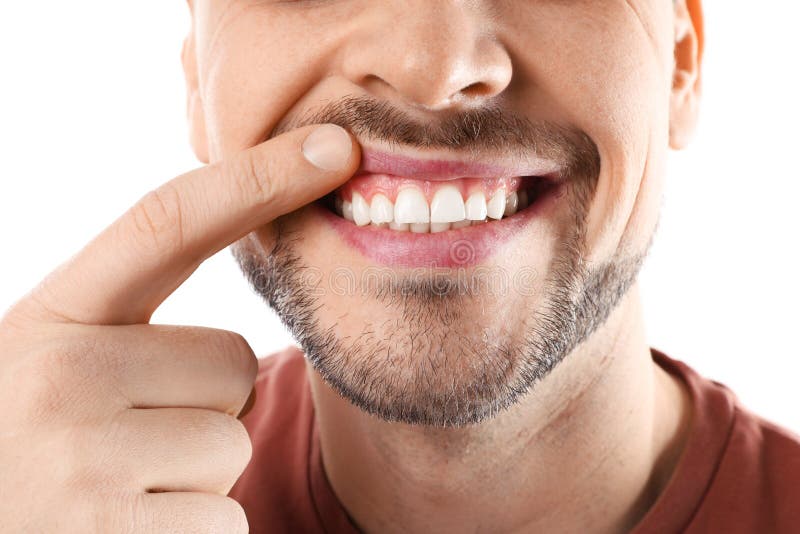 242 Smiling Male Straight Teeth Stock Photos - Free & Royalty-Free ...