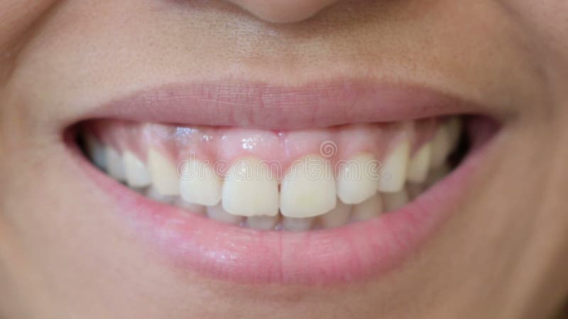 Smiling Mouth of African Woman, Lips and Teeth Stock Footage - Video of ...