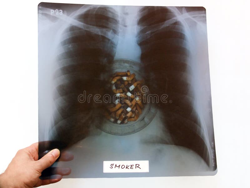 Smoker stock image. Image of nicotined, smoker, cigarette - 3715363