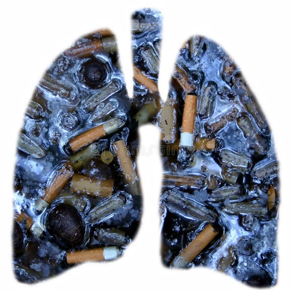 Smokers lungs stock photo. Image of anatomy, cigarettes - 945380