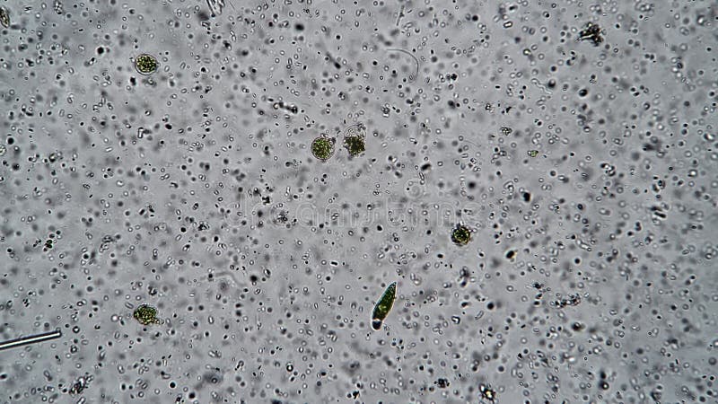 Smooth Movement of Camera Behind Variety of Microorganisms Under a ...