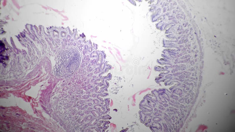 Longitudinal Section of Human Tongue Showing Filiform Papillae Under ...