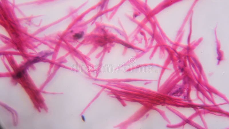 Smooth Muscle of Human Being in Longitudinal Section Filmed Under ...