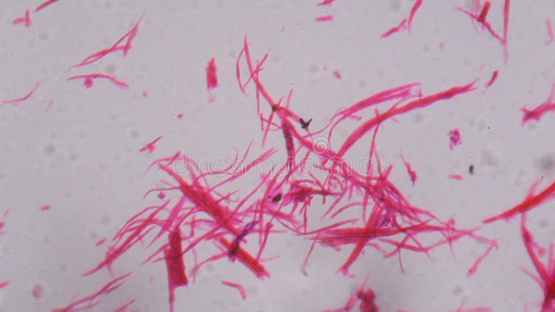 Smooth Muscle of Human Being in Longitudinal Section Filmed Under ...
