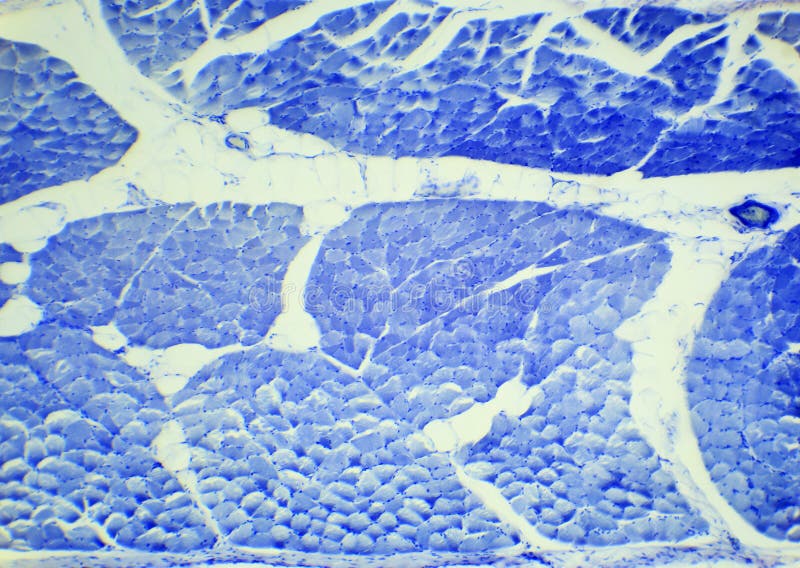 Smooth Muscle Teased Preparation Under a Microscope, Smooth Musc Stock ...