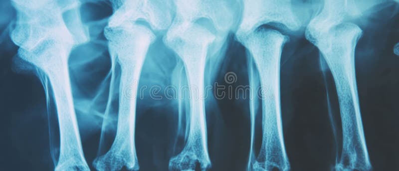 Smooth and Uniform X-ray Texture Showcasing Human Skeletal Structure in ...
