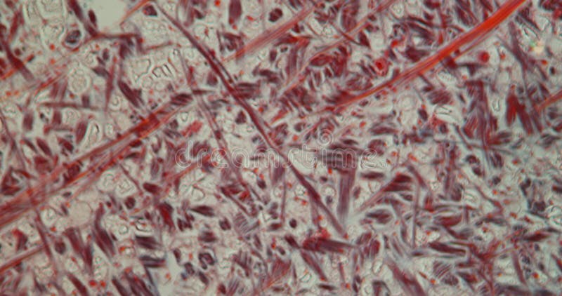 Snail foot stock video. Video of macro, secretion, foot - 204638501