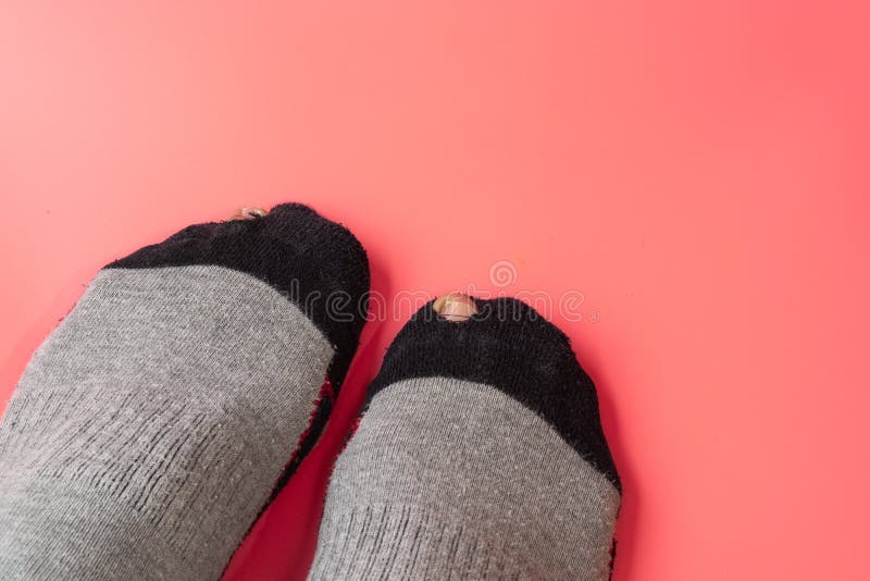 Broken Sock with a Hole in a Female Legs. Holes on the Heels of the ...