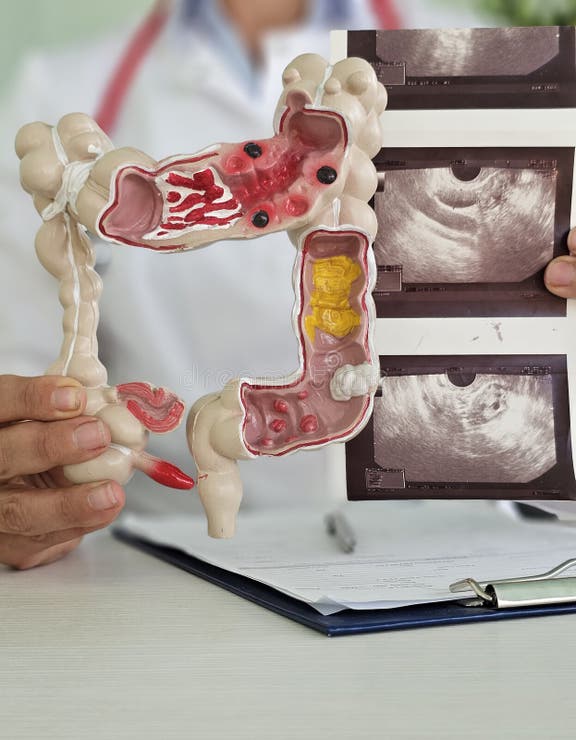 Soft Tissue and Bowel Examination Ultrasound Image Concept Stock Image ...