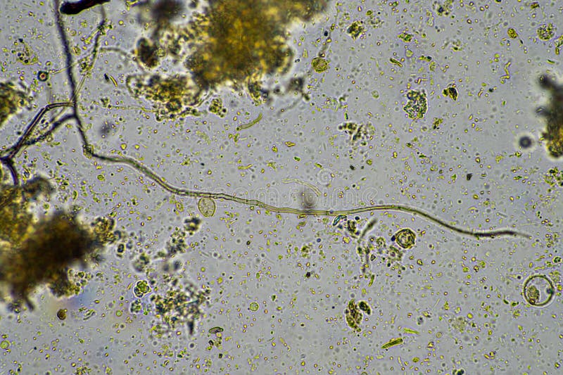 Soil Microbes Under the Microscope. Microorganisms with Fungus Stock ...