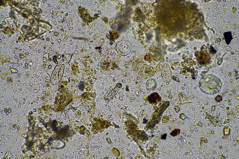 Soil Microbes Under the Microscope. Microorganisms with Fungus Stock ...