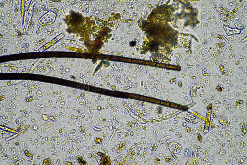 Archaea Microscope Stock Photos - Free & Royalty-Free Stock Photos from ...