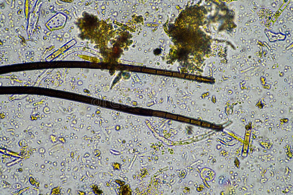 Soil Microorganisms Close Up Under the Microscope. in a Soil Samlple ...