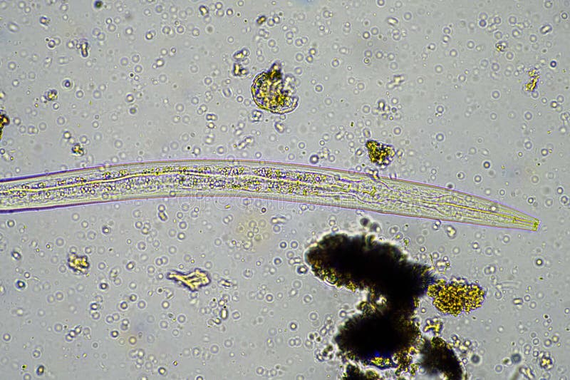 Soil Microorganisms Including Nematode, Microarthropods, Micro ...
