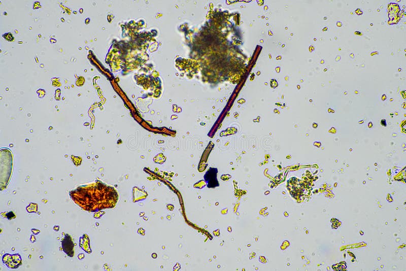 Soil Sample Under the Microscope. Soil Fungi and Microorganisms Cycling ...