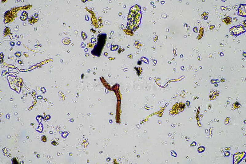 Soil Sample Under the Microscope. Soil Fungi and Microorganisms Cycling ...