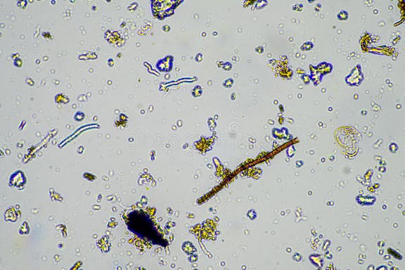 Soil Sample Under the Microscope. Soil Fungi and Microorganisms Cycling ...