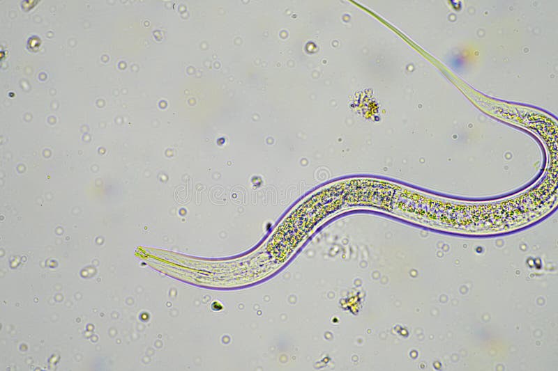 Soil Switcher Nematode, Microorganism and Soil Biology, with Nematodes ...