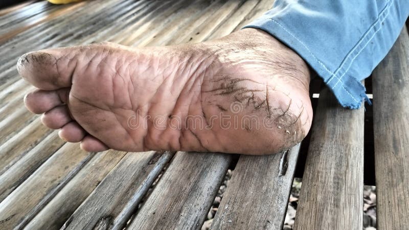 The Soles of the Feet of Hardworking Men during the Day Stock Image ...