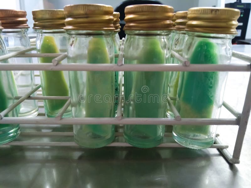 Solid Lowensteinâ€“Jensen Agar Medium Bottle. Stock Image - Image of ...