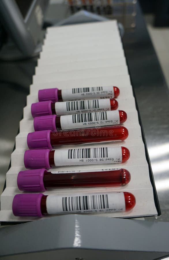 Blood test tubes in a tray stock image. Image of laboratory - 163008195