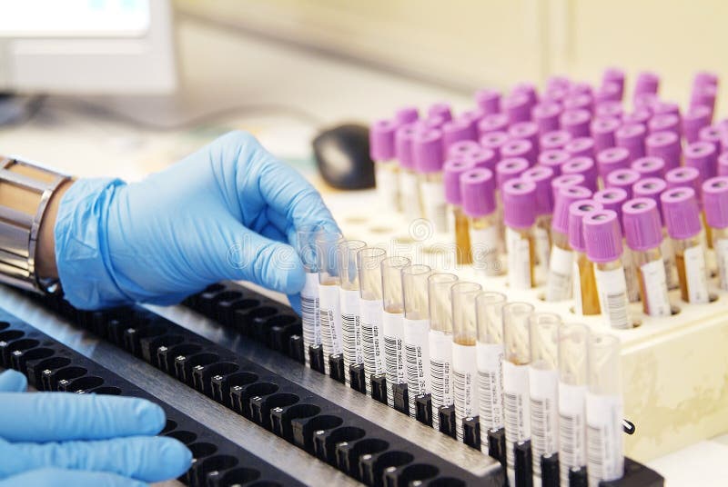 Sorting Blood Tubes into Racks in the Analysis Laboratory Editorial ...