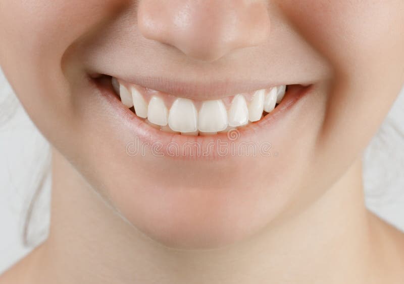 Sourire De Ladolescence Avec Les Dents Parfaites Blanches Photo Stock