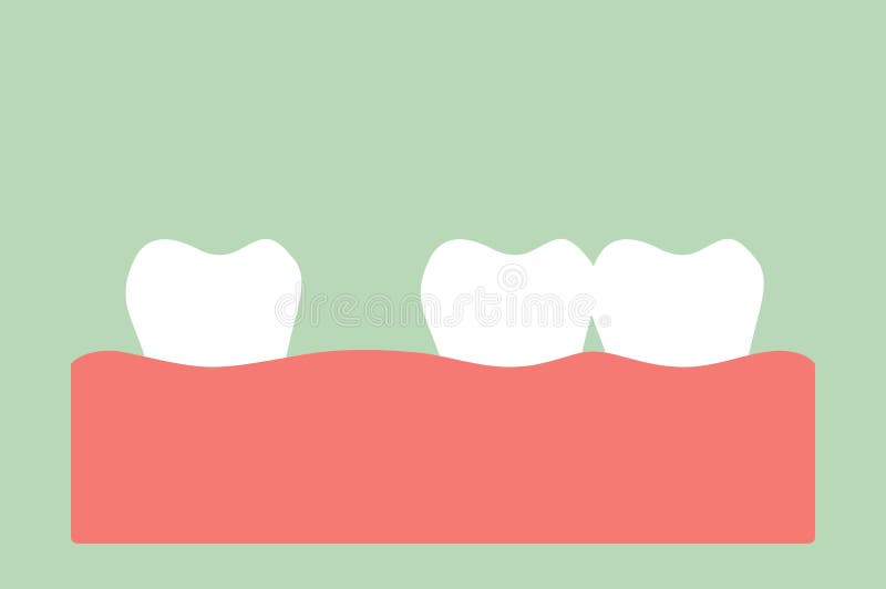 Teeth Gap Cartoon Stock Illustrations – 125 Teeth Gap Cartoon Stock ...