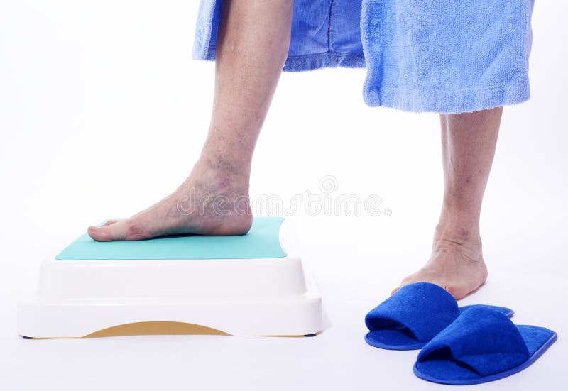 Spataders Op Witte Achtergrond Stock Foto - Image of varikeus, geduldig ...