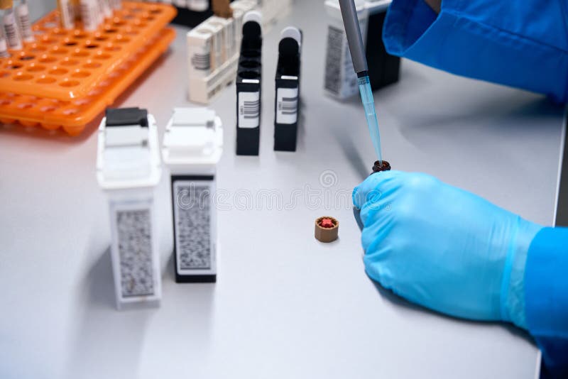 Specialist Works with Blood Samples in Test Tubes Stock Photo - Image ...