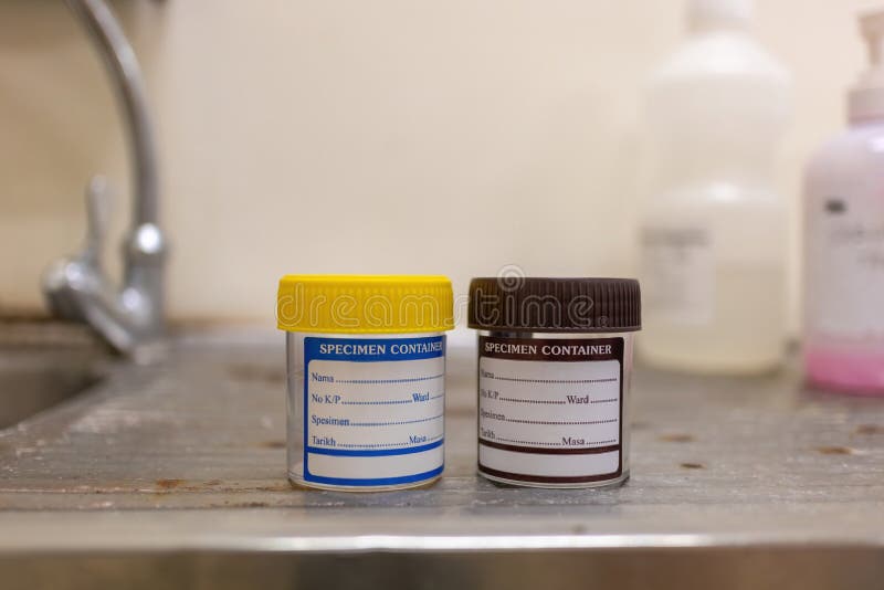 A Specimen Container for Lab Test Stock Image - Image of laboratory ...