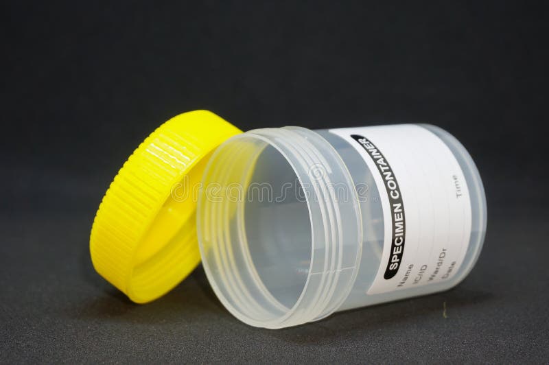 Specimen Container stock photo. Image of sterile, exam - 84229456