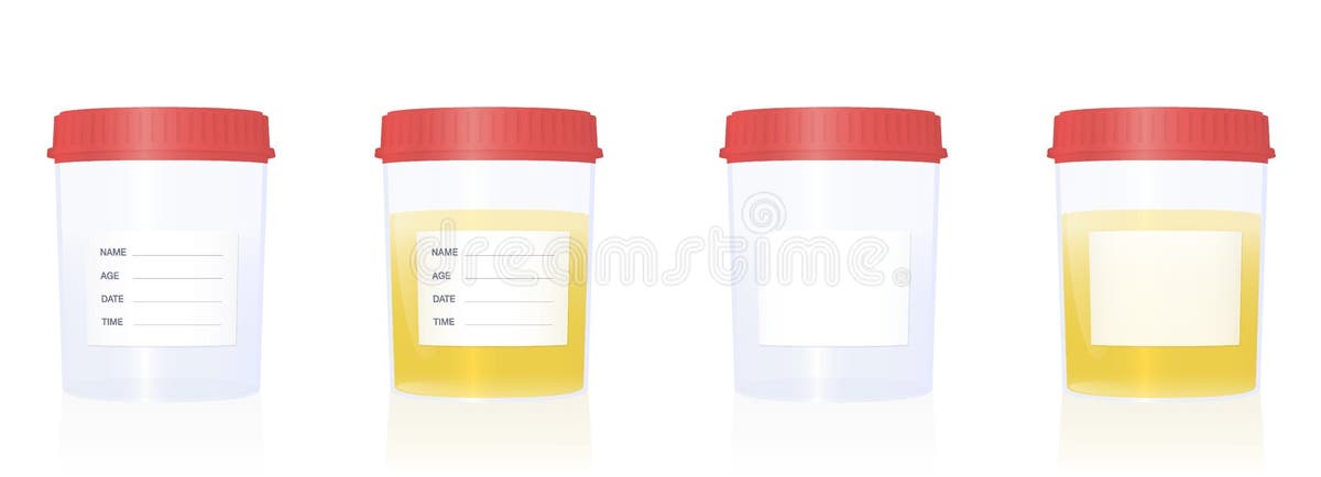 Urine Sample Analysis Stock Illustrations – 623 Urine Sample Analysis ...