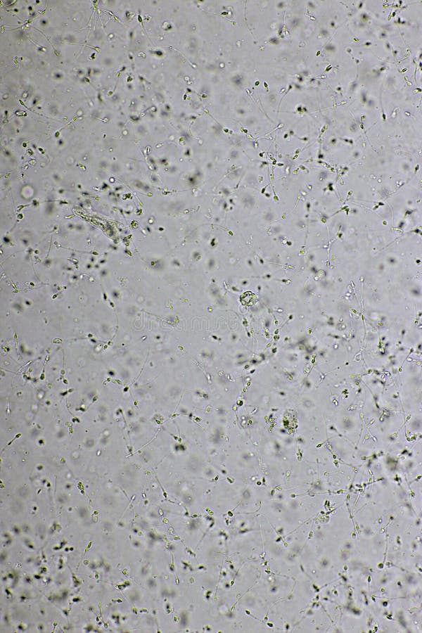 Sperm Microscope 400x