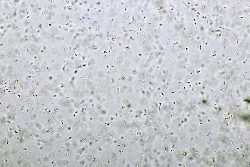 Sperm Microscope 400x